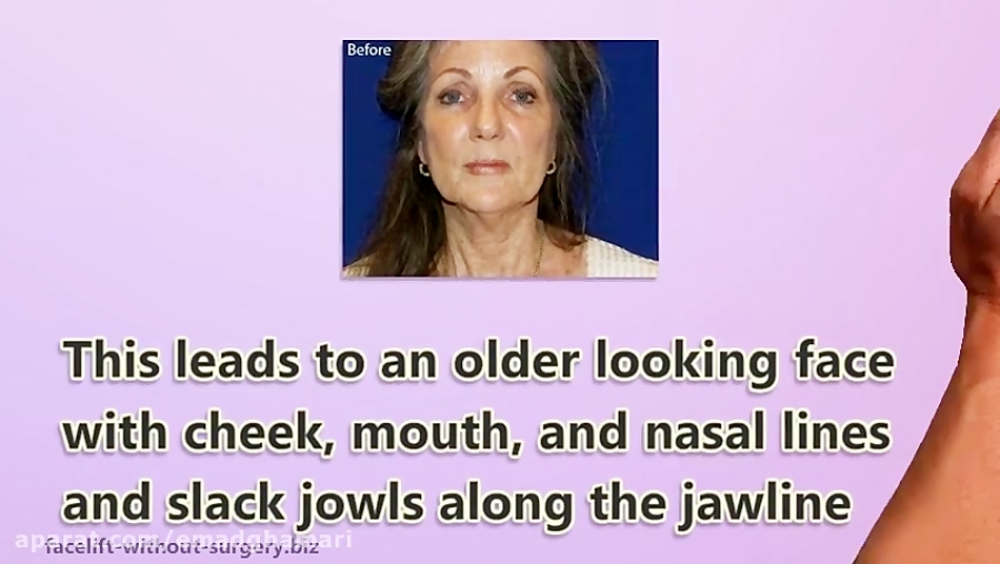 Got A Thin Face? Gain Chubby Cheeks With These Face Exercises To Boost ...