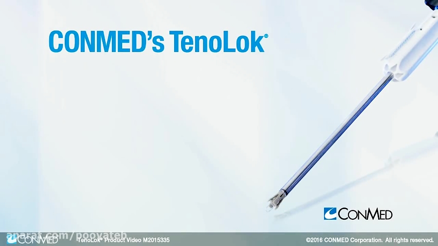 TenoLok® Dual-Expanding Biceps Tenodesis Anchor - CONMED Product Video