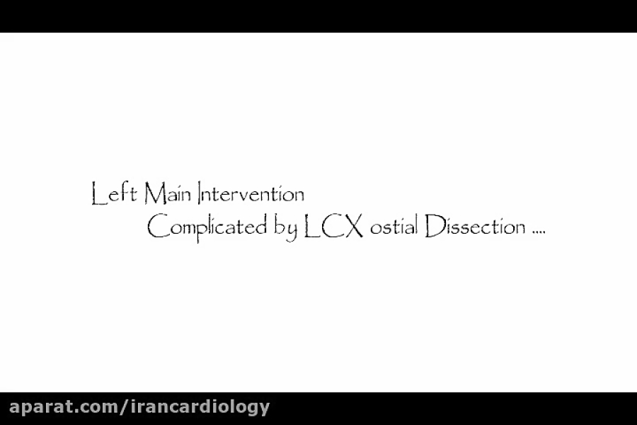 Left Main Intervention Complicated by LCX Ostial Dissection
