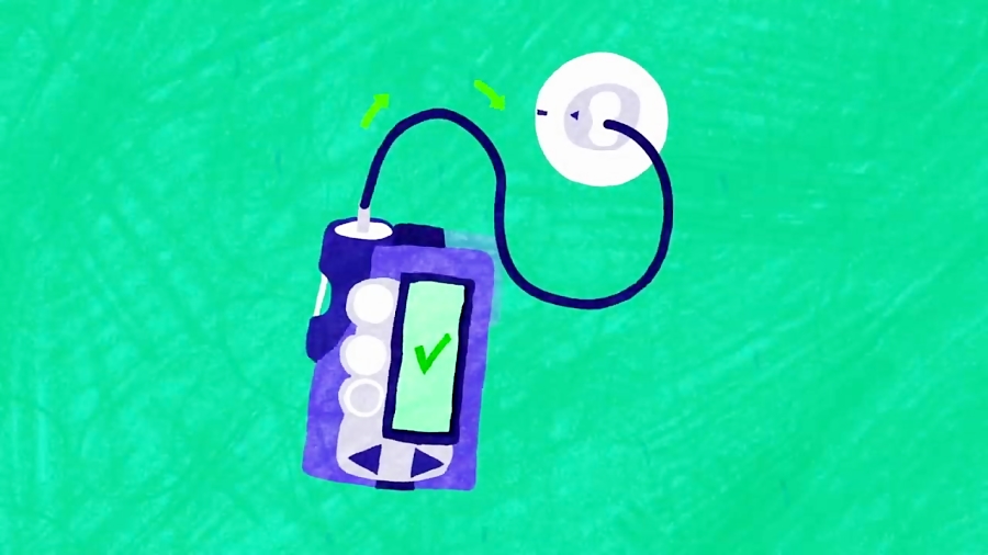 Your body vs. Implants - Kaitlyn Sadtler
