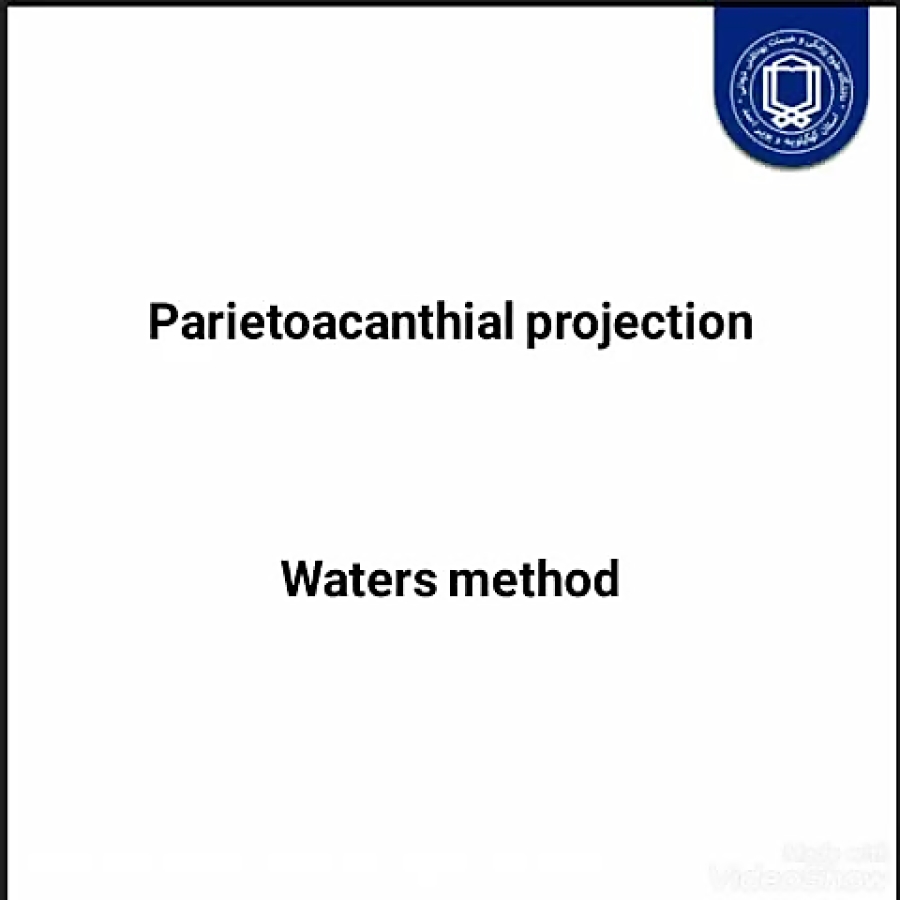 سینوس های پارانیزال WATERS METHOD