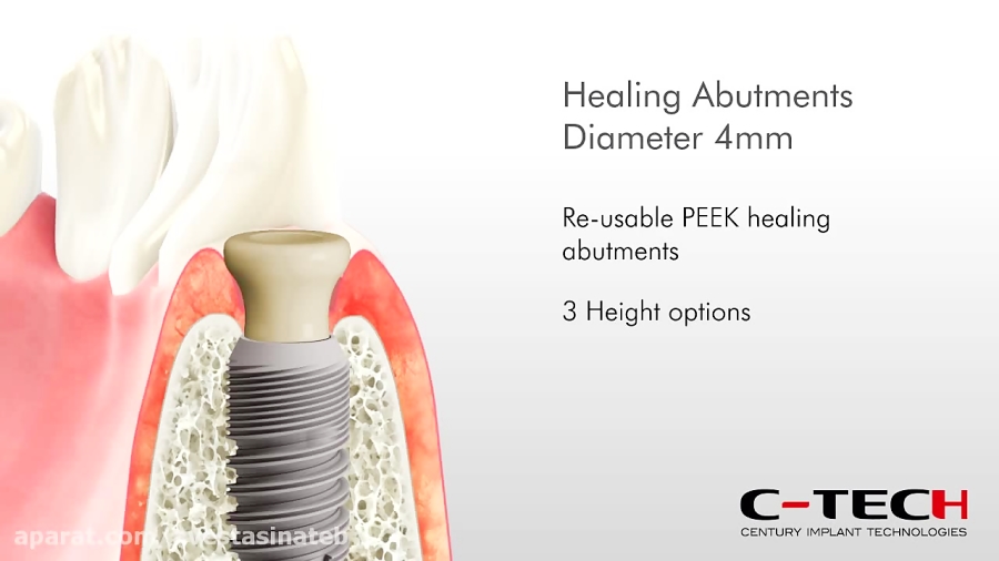 ESTHETIC LINE prosthetic