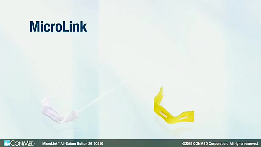 MicroLink™ All-Suture Button - CONMED Product Video