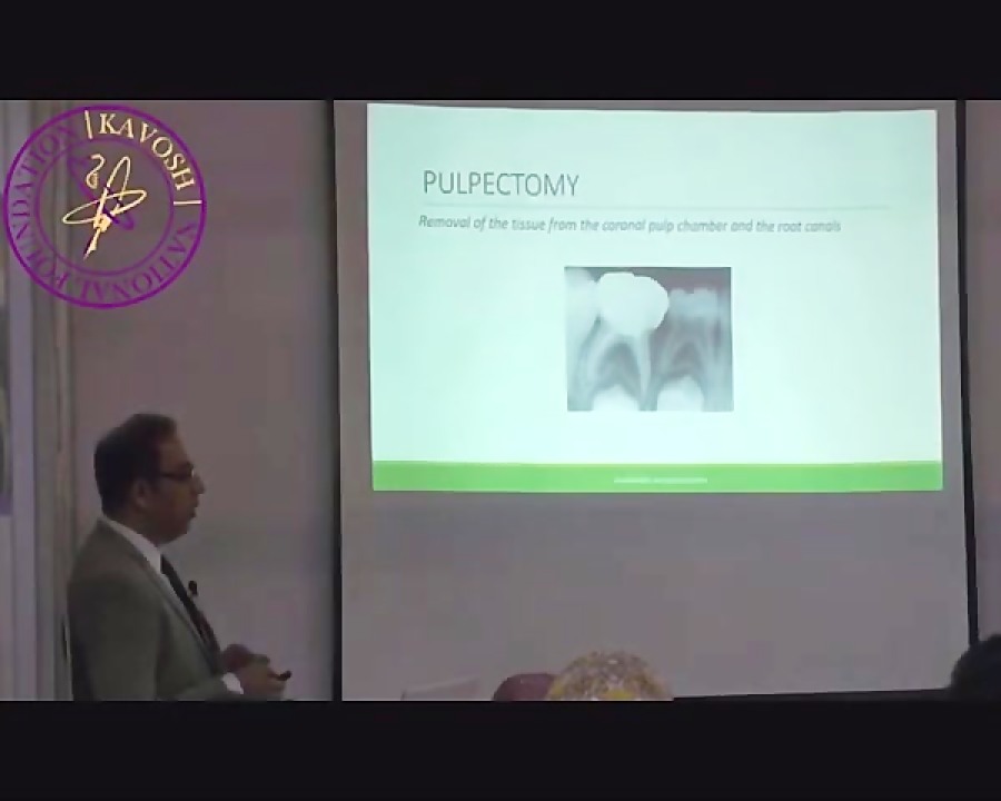 Pulpectomy روش، معیارهای موفقیت و شکست درمان ( دکتر باقی )