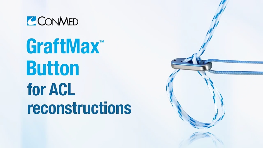 GraftMax Button Cortical Fixation Device - Product Video