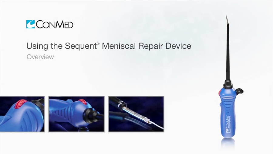 Sequent Meniscal Repair Device - Tutorial Animation