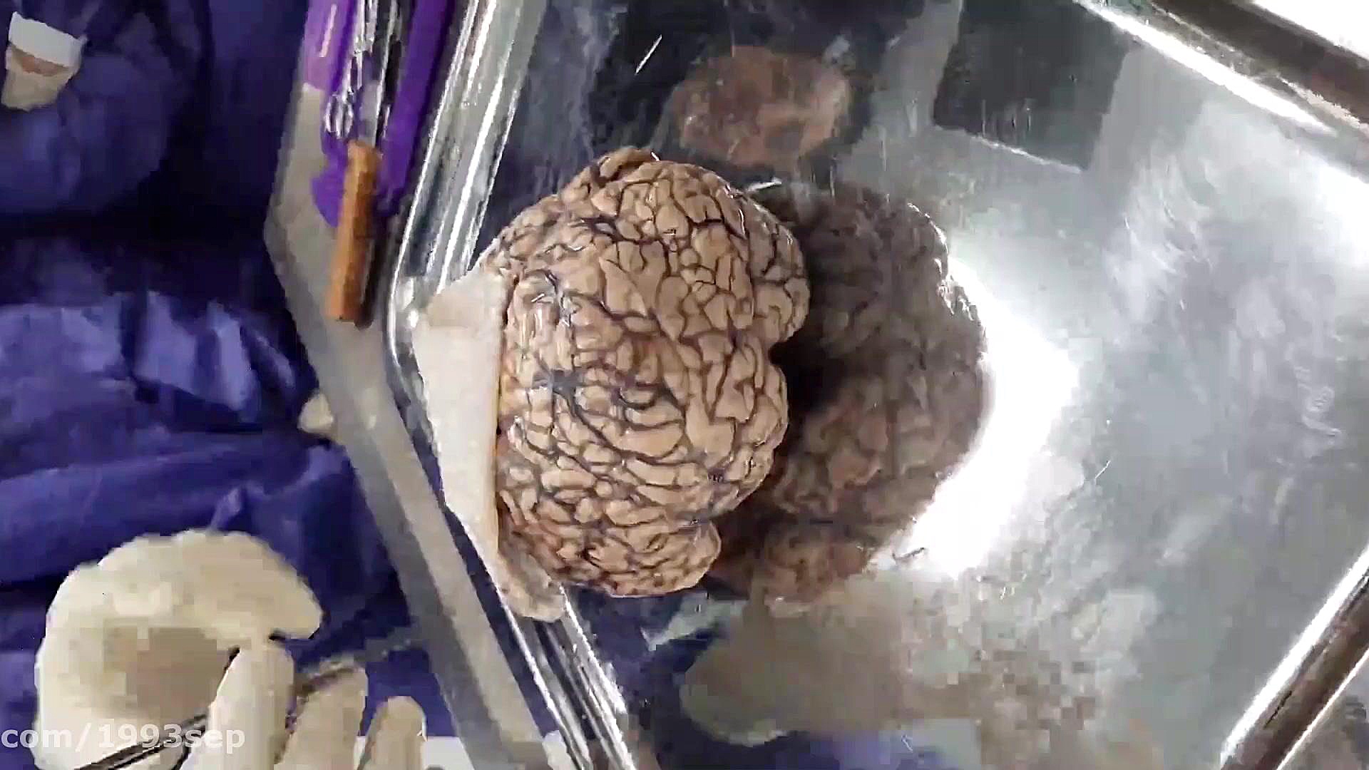 لوب های مغز-