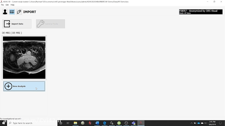 Electrophysiology ADAS 3D LA - Cardiac MRI and CT Software