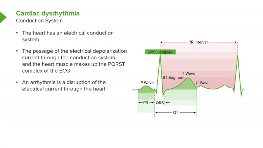 Conduction System Cardiac Dysrhythmia