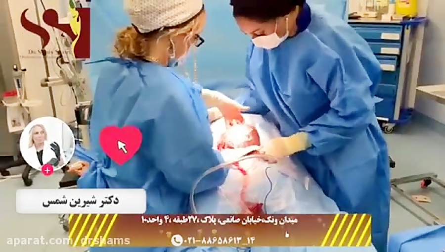فیلم زایمان سزارین موفق با وجود پیچیدن دو دور بند ناف دور گردن نوزاد