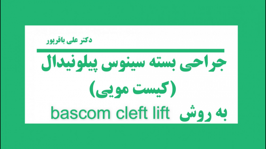 جراحی بسته کیست مویی به روش bascom cleft lift