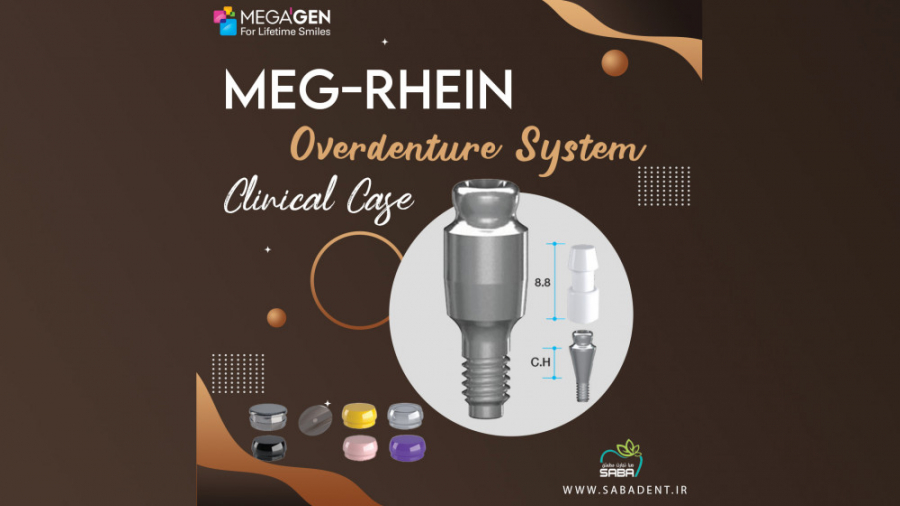 Meg-Rhein Overdenture System | اباتمنت مگ راین مگاژن | صبا تجارت