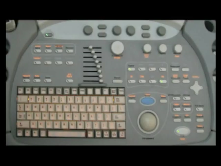 mild mr در اکو قلبی