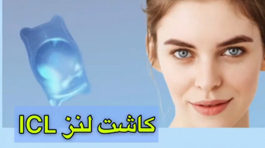 کاشت لنز ICL