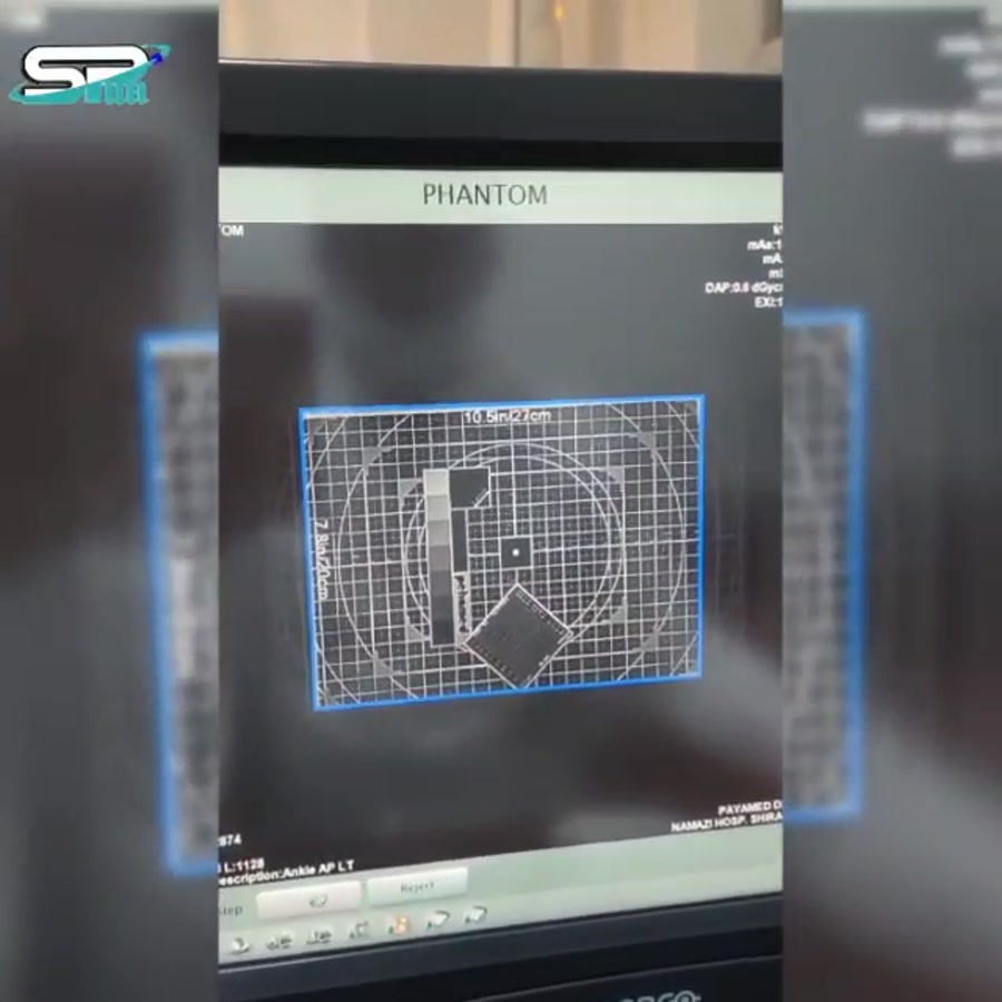 بررسی پارامترهای کیفیت تصویر در رادیولوژی