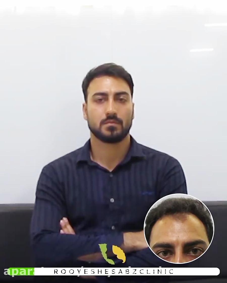 کلینیک تخصصی کاشت مو رویش سبز
