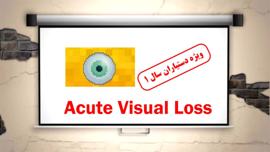 Acute Visual Loss - H.Khojasteh MD - 1399.10.02