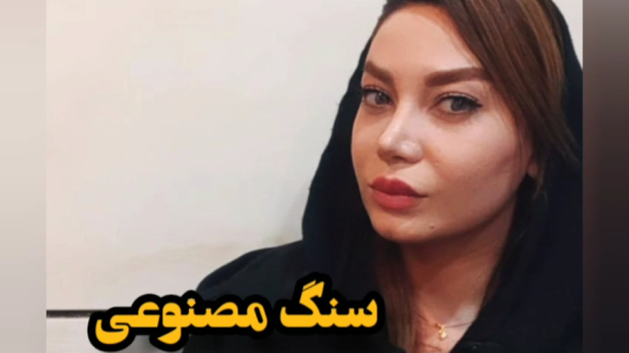 تراورتن عباس ّآباد مصنوعی