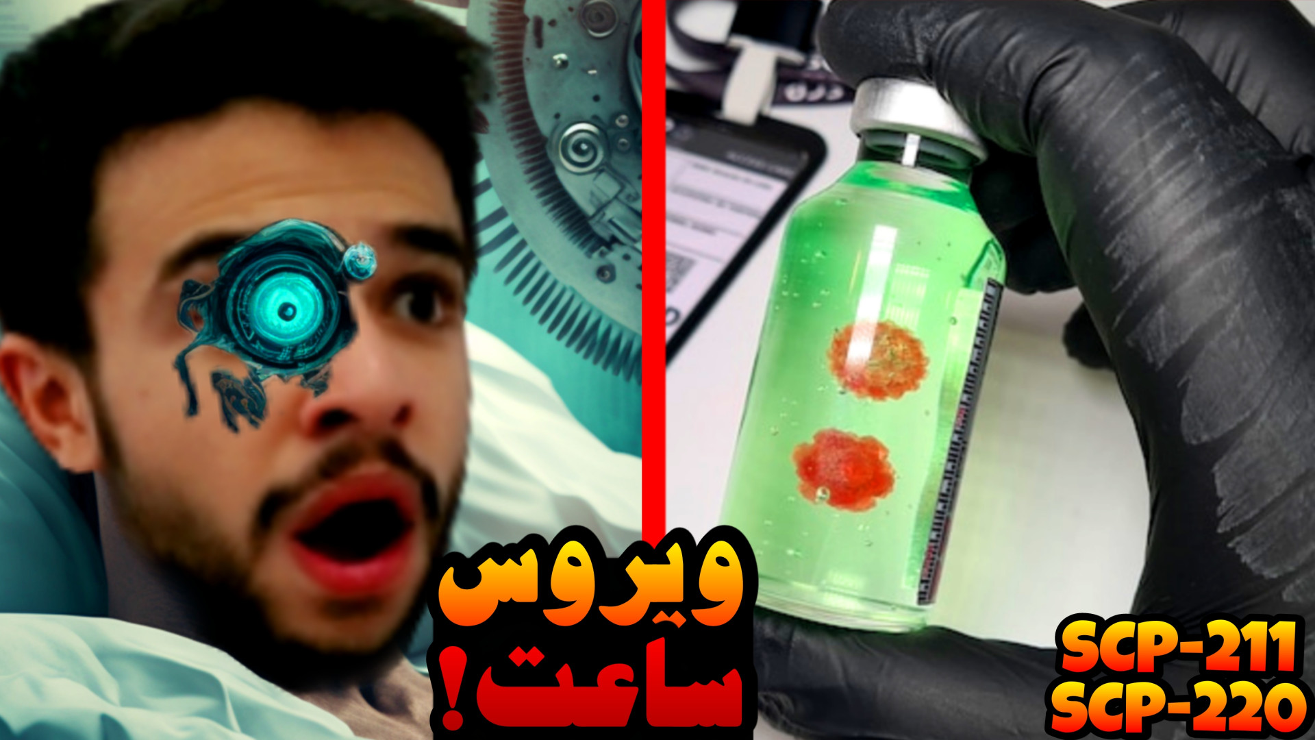 همه مو های بدن رو میخوره !! (SCP-331_SCP-340)