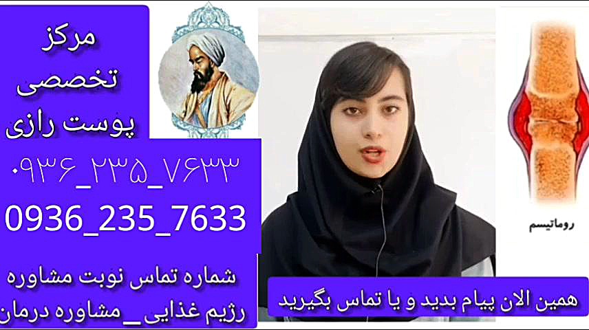 تفاوت آرتروز و روماتیسم جهت درمان قطعی همین الان تماس بگیرید ۰۹۳۶۲۳۵۷۶۳۳