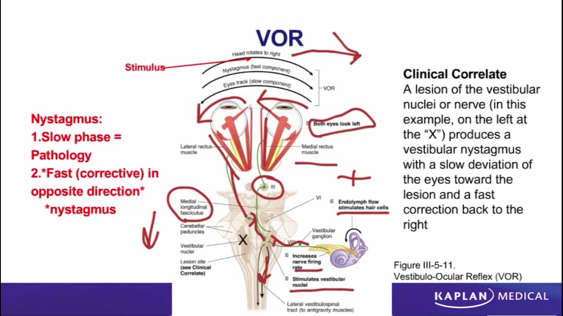 091. Anatomy - Sec III The Brain Stem - Vestibular System
