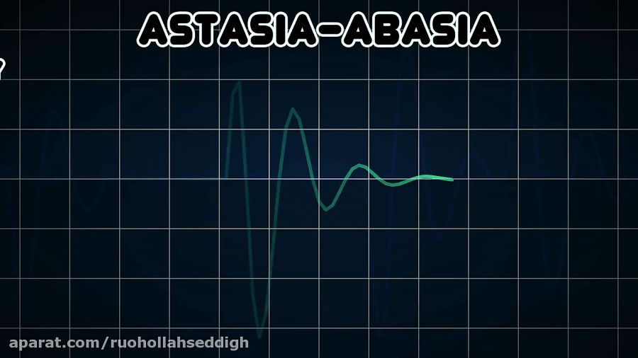 Astasia-abasia (Medical Symptom)