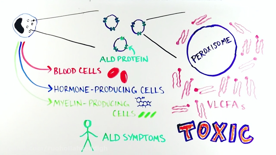 WHAT IS ALD? Adrenoleukodystrophy explained.