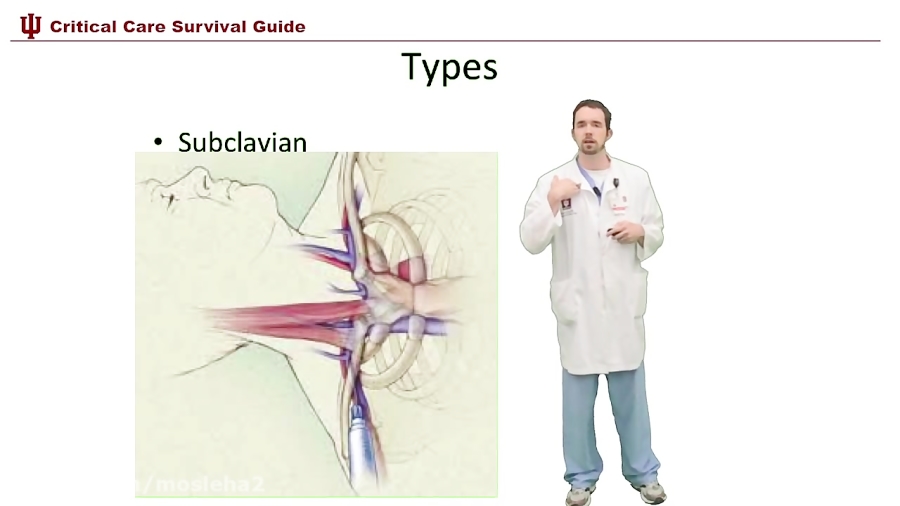 Central lines in ICU