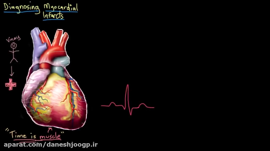 Heart Attack Myocardial Infarct Diagnosis Nclex Rn Khan Academy