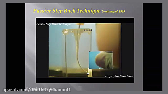 آموزش تکنیک پاسیو استپ بک (Passive Step Back Technique)